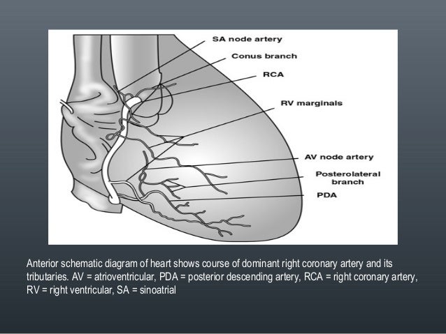 Coronary Sinus