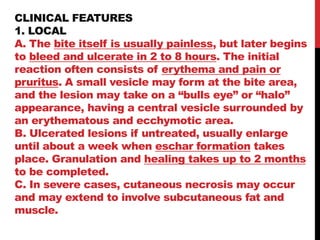 Presentation on aranea envenomation | PPTX