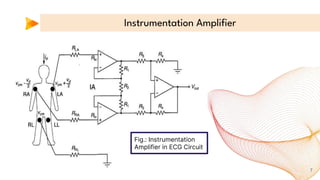 Right-Leg-Driven Circuit and Instrumentation Amplifier in ECG ...