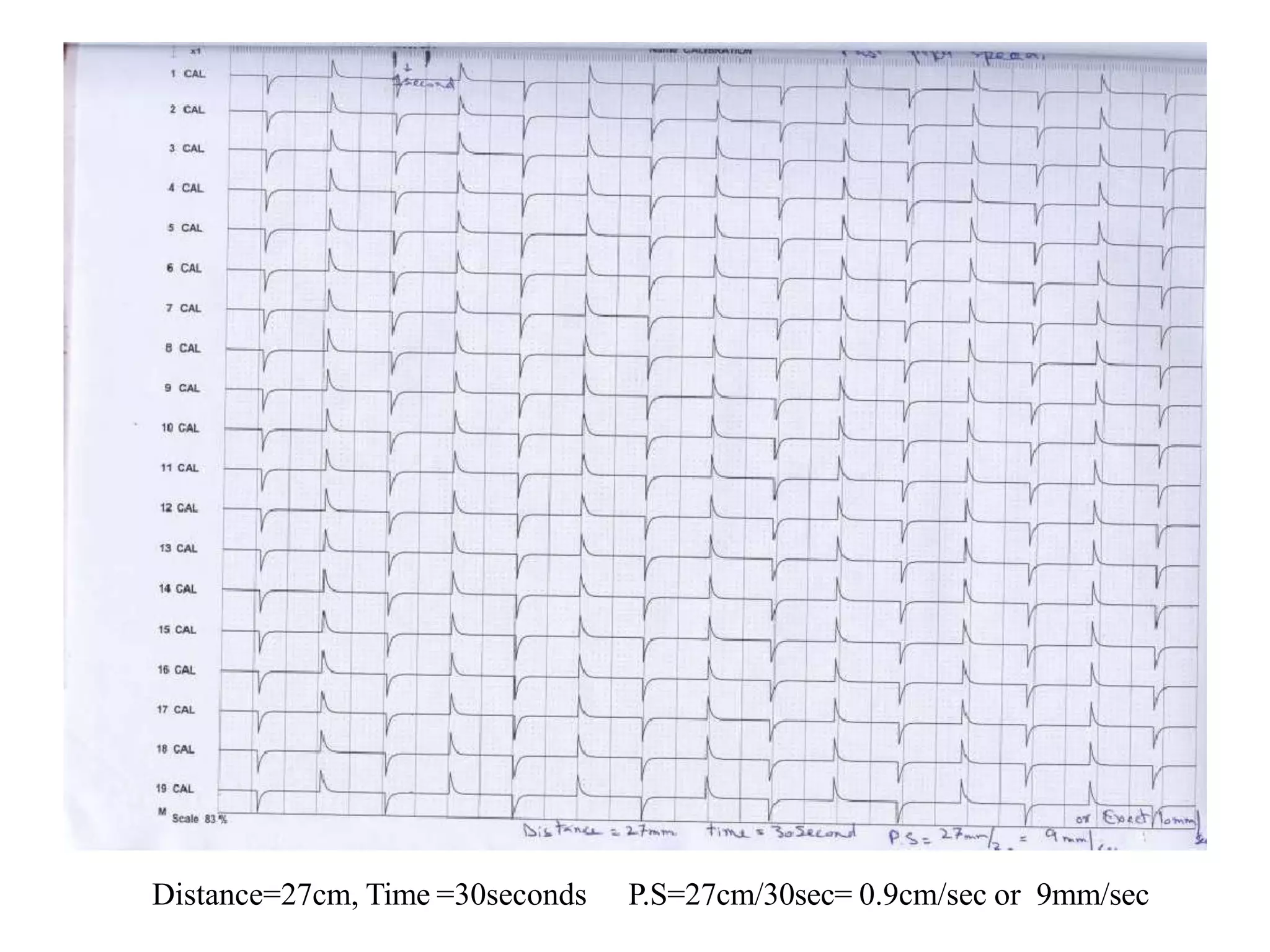 Eeg Calibration And Its Steps Pptx Technology And Computing
