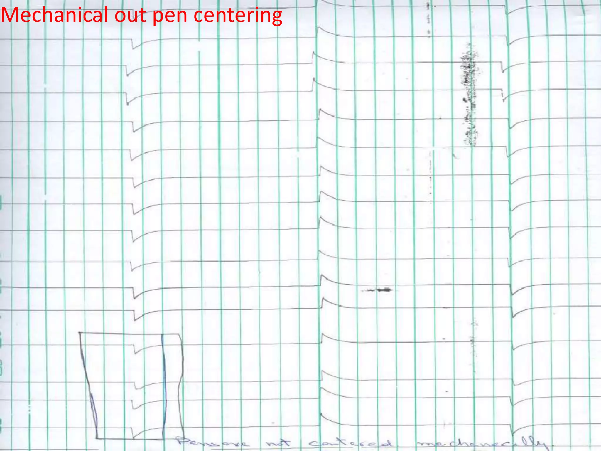 Eeg Calibration And Its Steps Pptx Technology And Computing