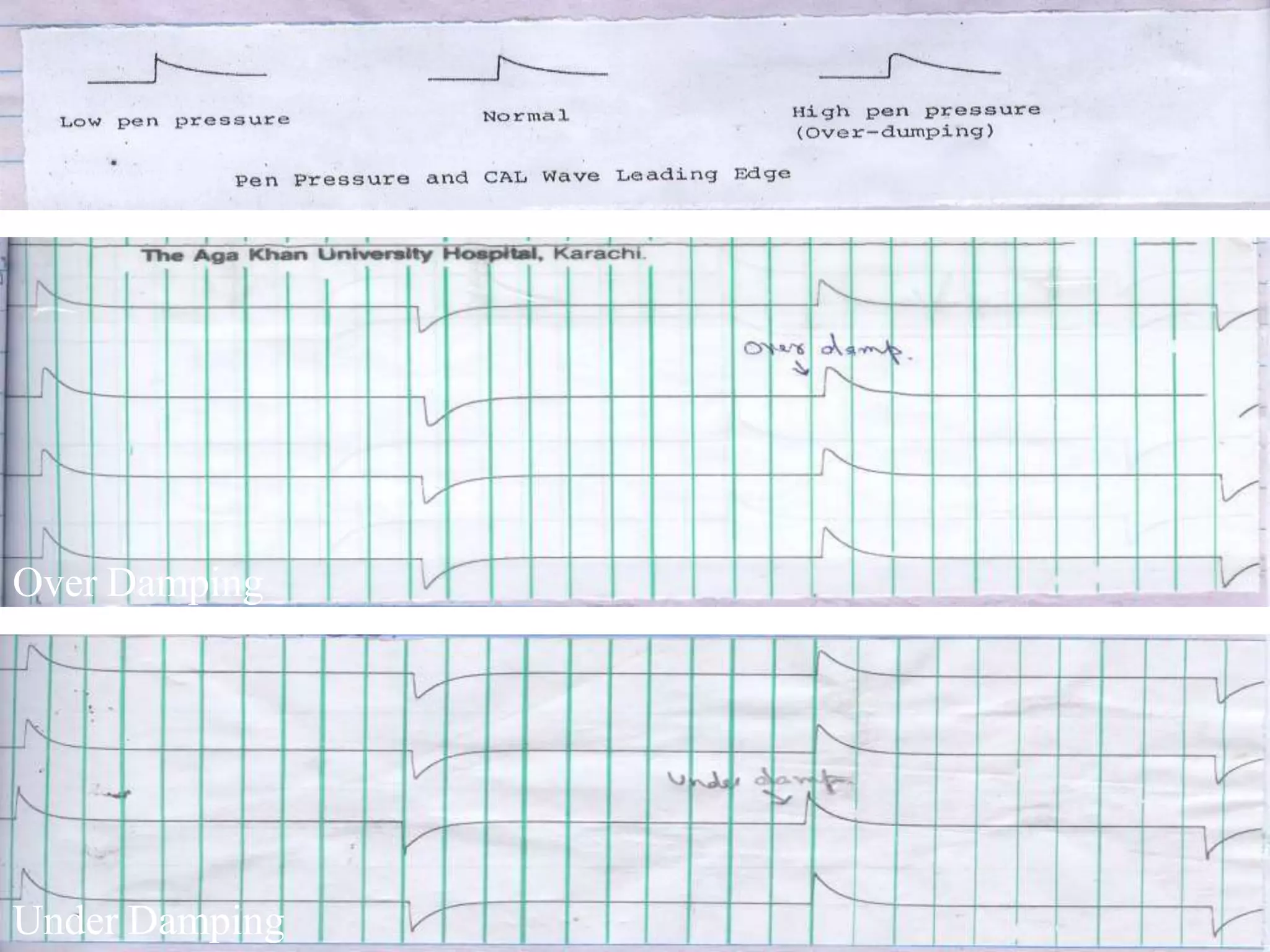 Eeg Calibration And Its Steps Pptx Technology And Computing