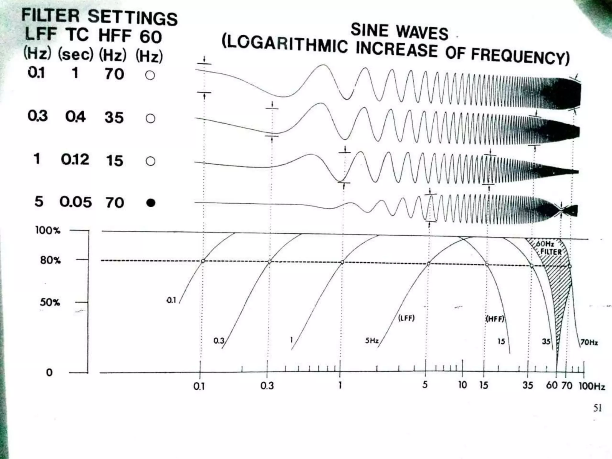 EEG calibration and its steps | PPTX
