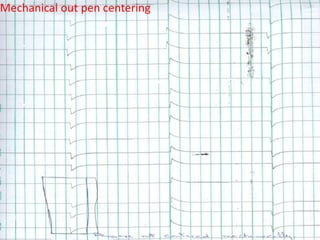 EEG calibration and its steps | PPTX