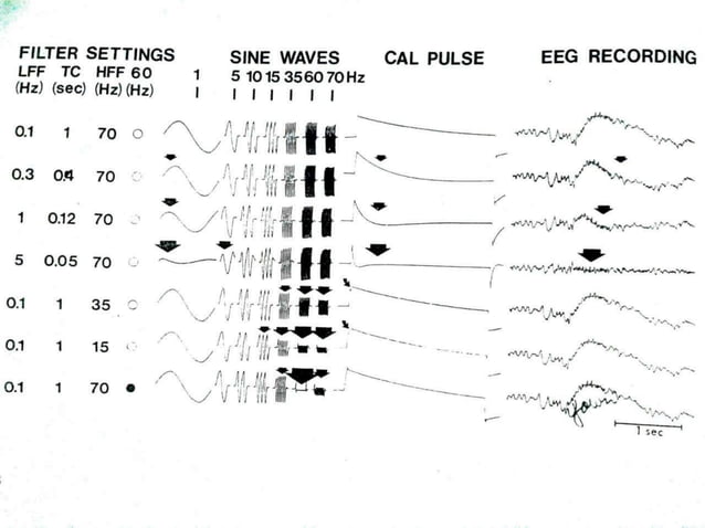 EEG calibration and its steps | PPTX | Technology & Computing