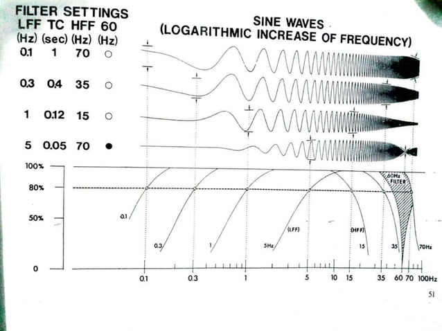 EEG calibration and its steps | PPTX | Technology & Computing