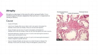 Presentation on Cellular Adaptation & Calcification by Dr. Anurag A ...