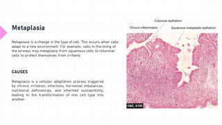 Presentation on Cellular Adaptation & Calcification by Dr. Anurag A ...