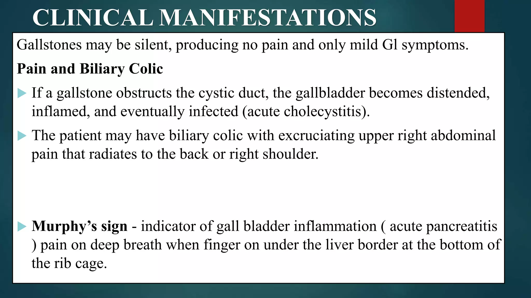 Presentation on cholelithiasis | PPTX
