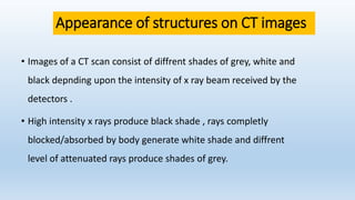 Presentation on CT Scan.pptx