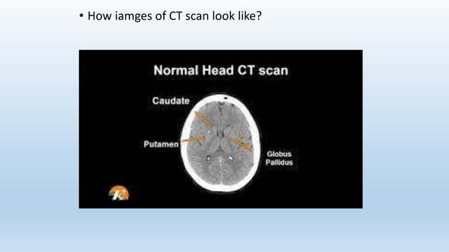 Presentation on CT Scan.pptx