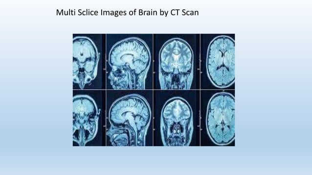 Presentation on CT Scan.pptx
