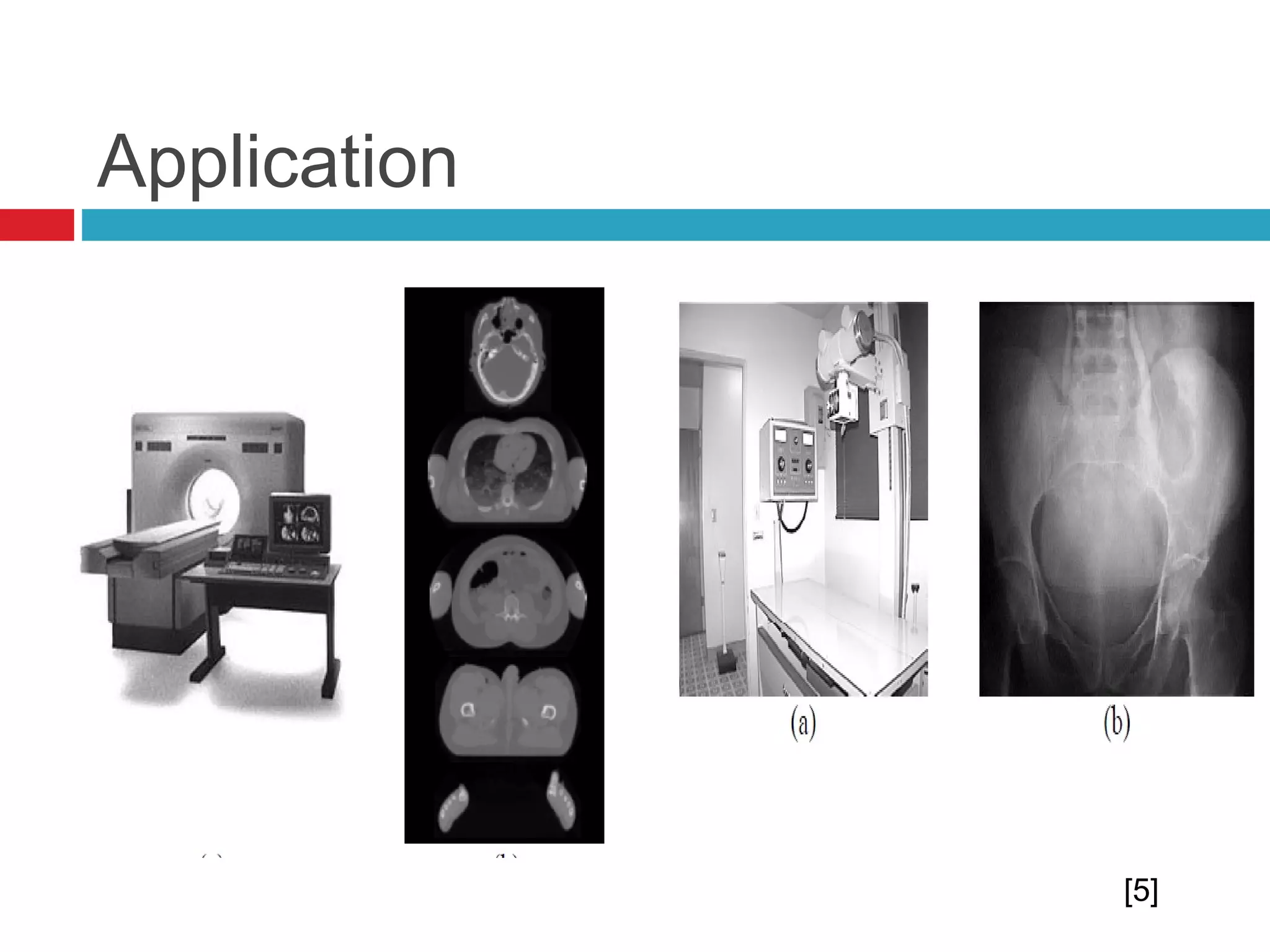 Presentation On Deformable Model For Medical Image Segmentation Ppt