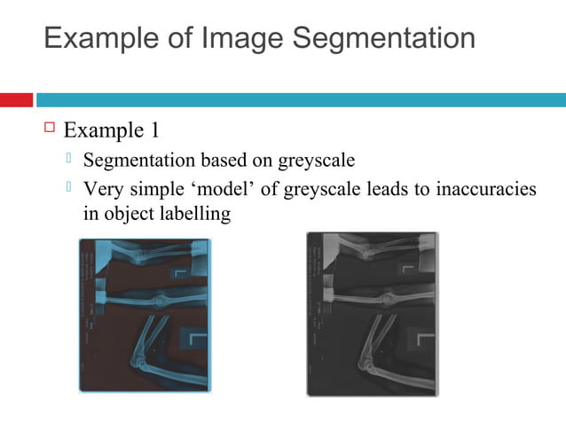 Presentation On Deformable Model For Medical Image Segmentation Ppt Photo Editing Software