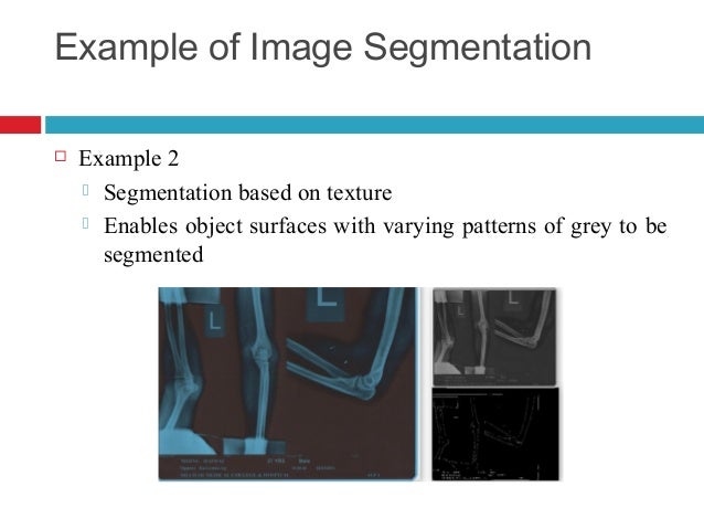 Presentation On Deformable Model For Medical Image Segmentation