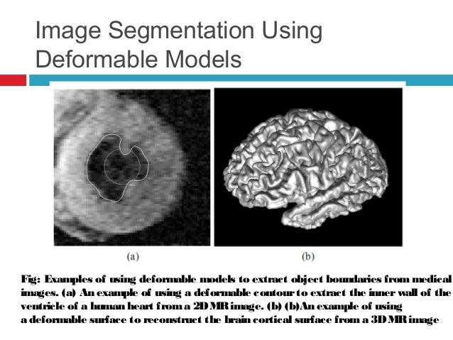Presentation On Deformable Model For Medical Image Segmentation