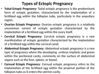 Presentation ON ECTOPIC PREGNANCY SEMINAR PRESENTATION | PPTX