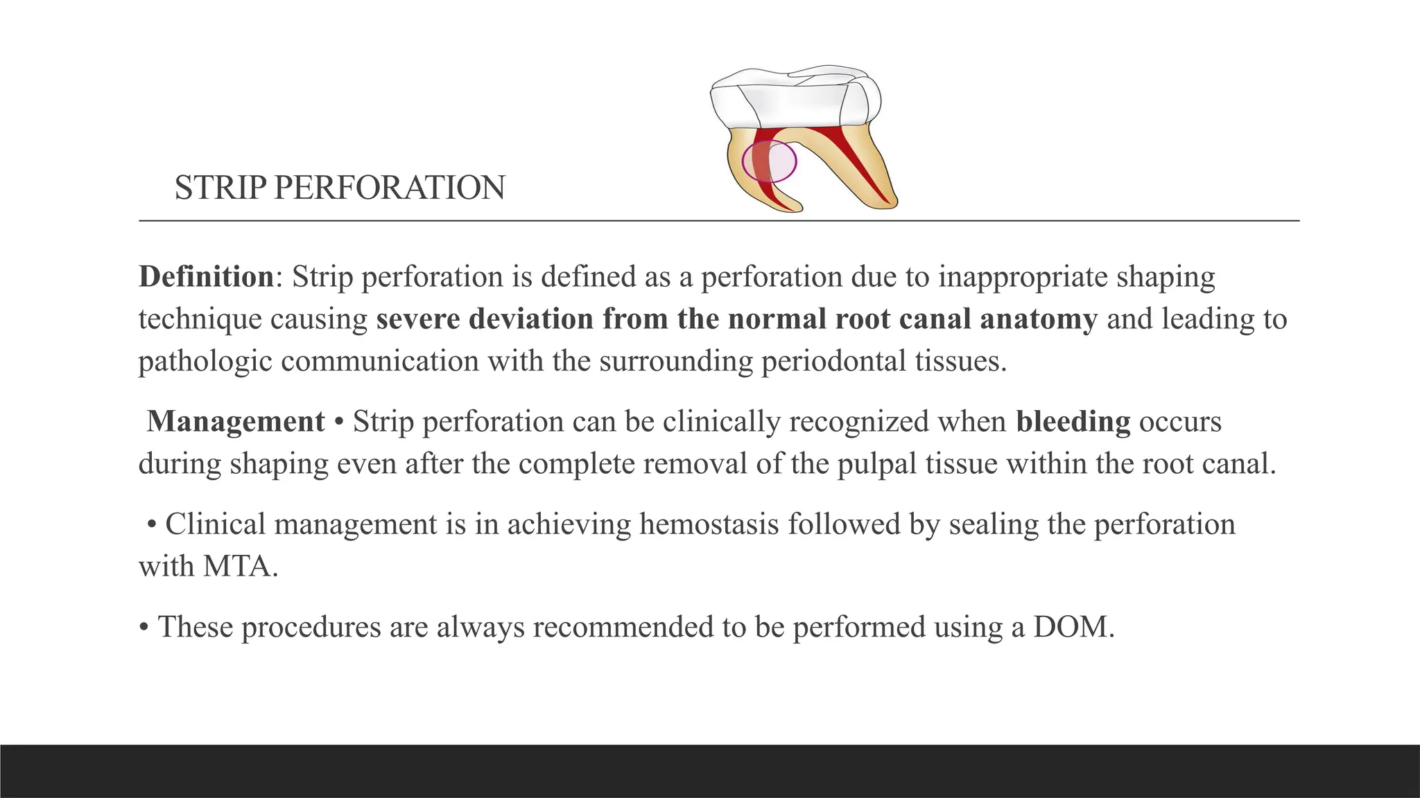 PRESENTATION ON ERRORS IN ENDODONTICS BY AKSHARA SHREE S 2.pptx