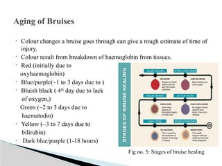 Presentation on examination of bruise.pptx