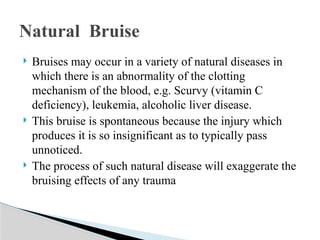 Presentation on examination of bruise.pptx