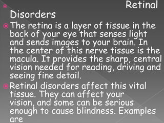 Presentation on eye | PPTX