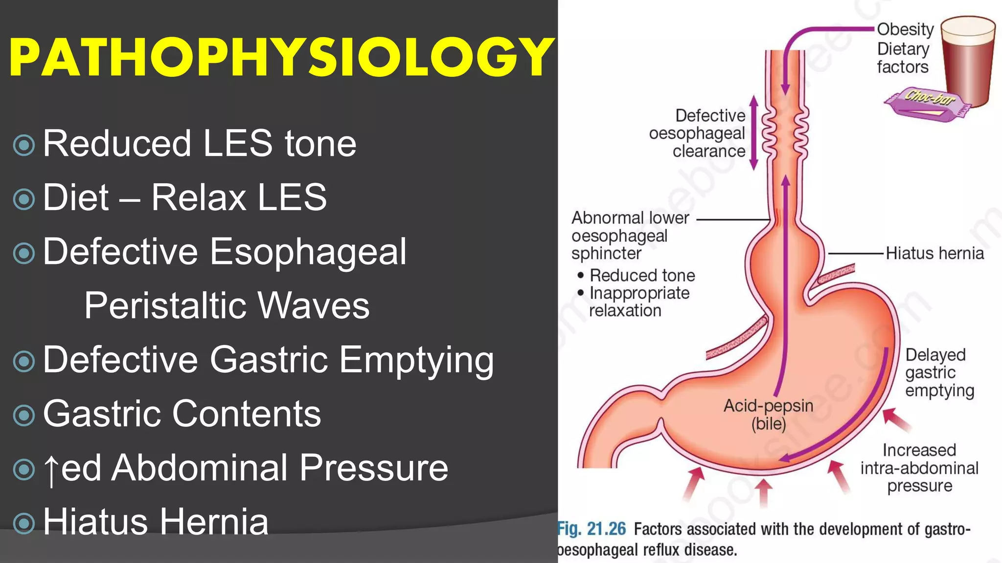 Presentation on GERD, Current Status of Diagnosis & Management | PPTX