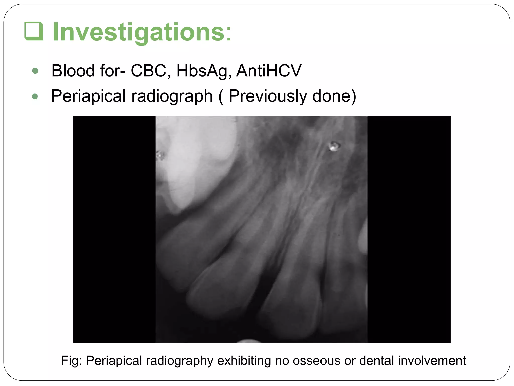 Case presentation on EPULIS | PPTX