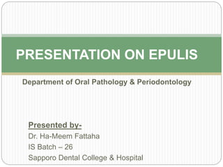 Case presentation on EPULIS | PPTX