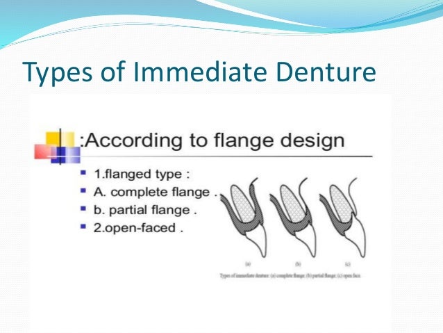 Immediate denture
