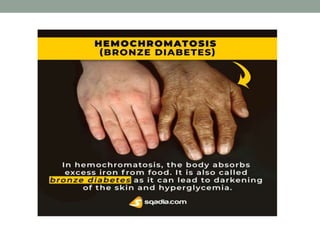 Hemochromatosis Bronze Skin