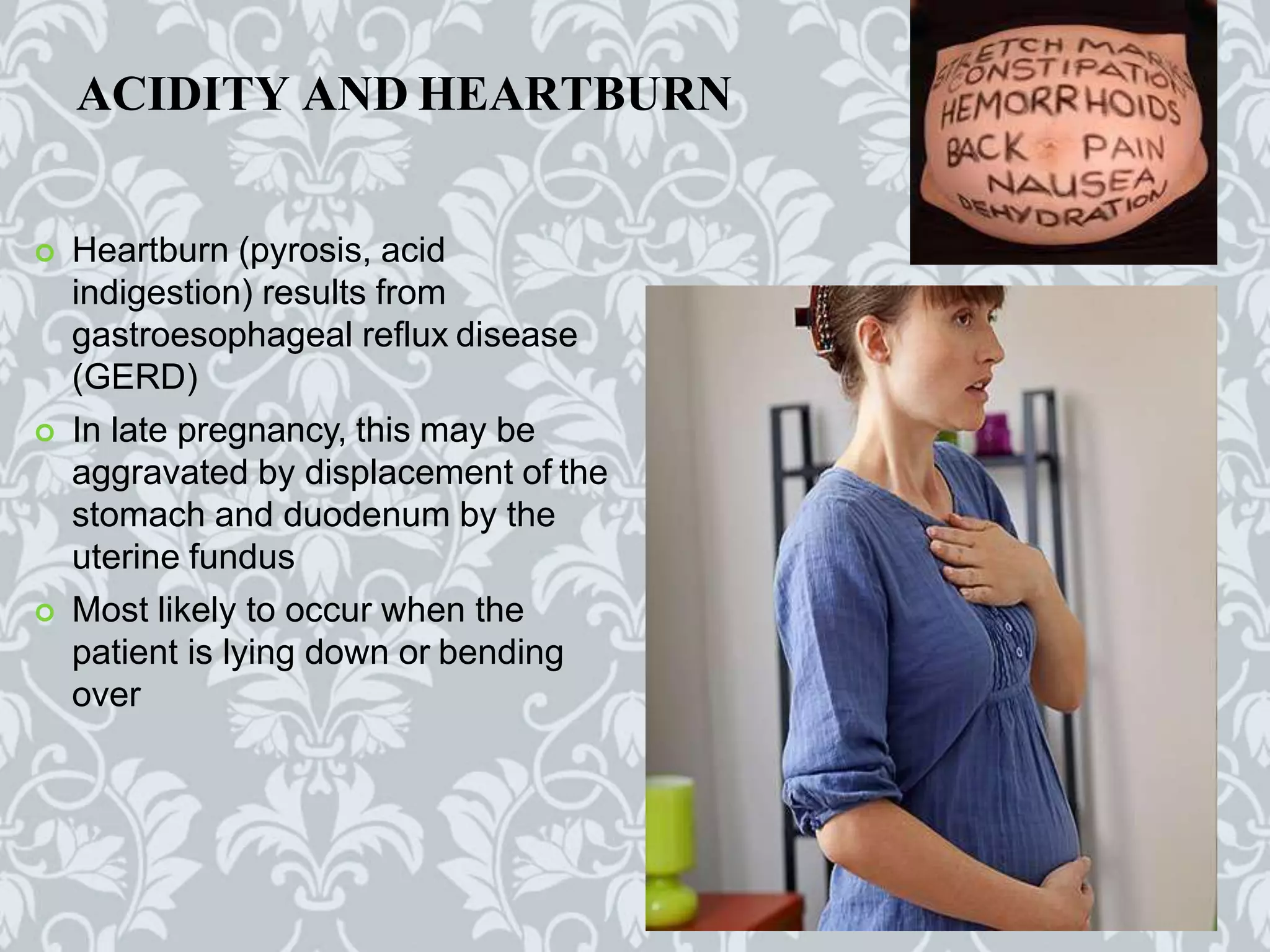 MINOR AILMENT DURING PREGNANCY | PPTX