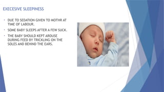 PRESENTATION ON MINOR DISORDER OF NEW BORN.pptx