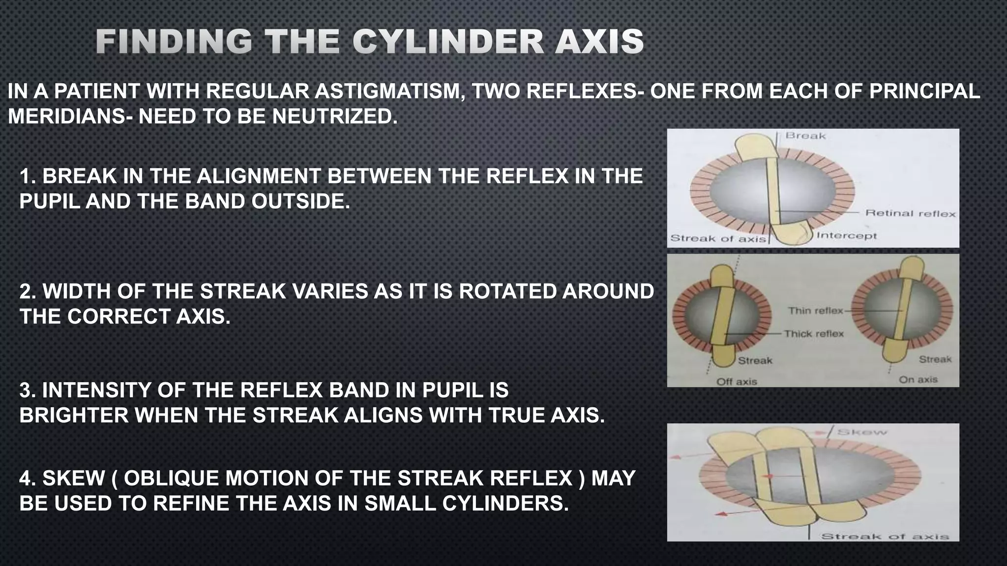 Presentation on Neutralization steps of retinoscopy.pptx