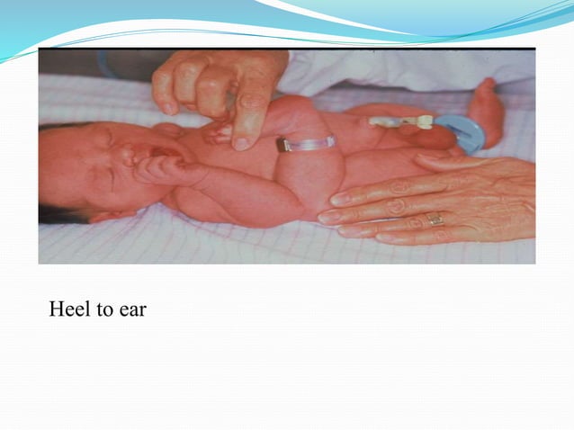 seminar on normal newborn... | PPTX | Pregnancy | Reproductive Health