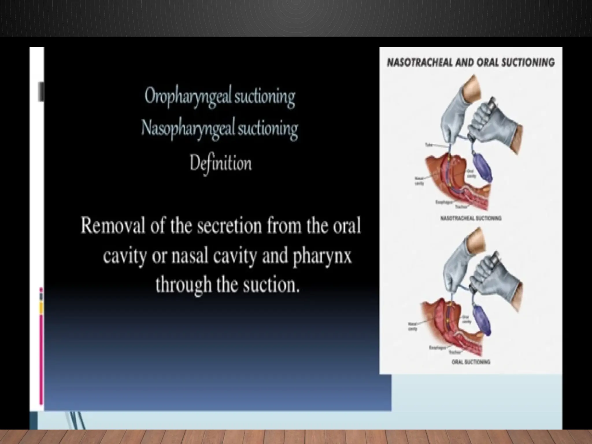 Presentation on orophayngeal ana Naspharyngeal suctioning.pptx