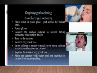 Presentation on orophayngeal ana Naspharyngeal suctioning.pptx