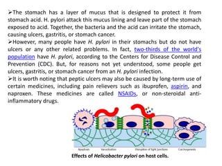 Presentation on peptic ulcer | PPTX | Digestive Disorders | Diseases ...