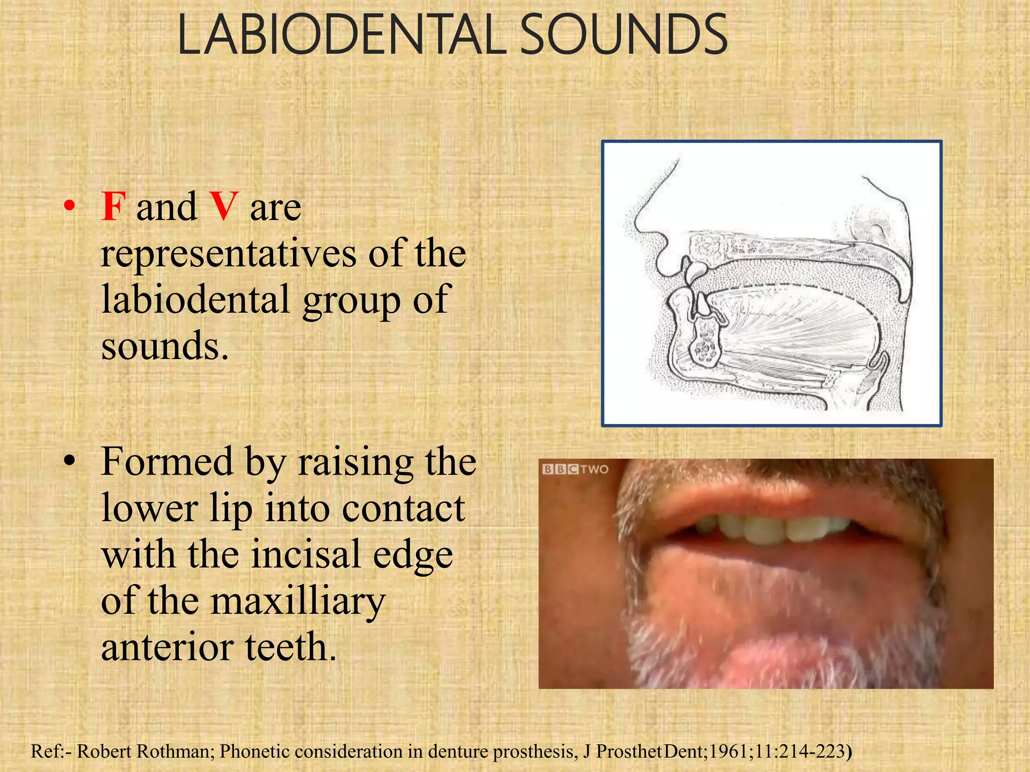 Phonitics In Complete Denture (with animations) | PPTX