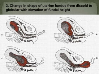 physiology and management of third stage of labour | PPT