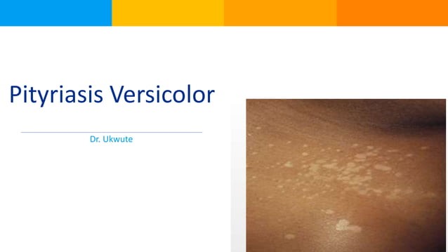 Presentation on Pityriasis Versicolor .pptx