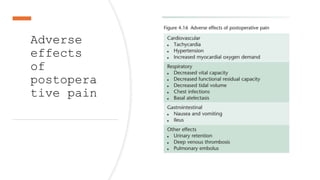Management of Post Operative Pain: to make doctors conscious about the ...