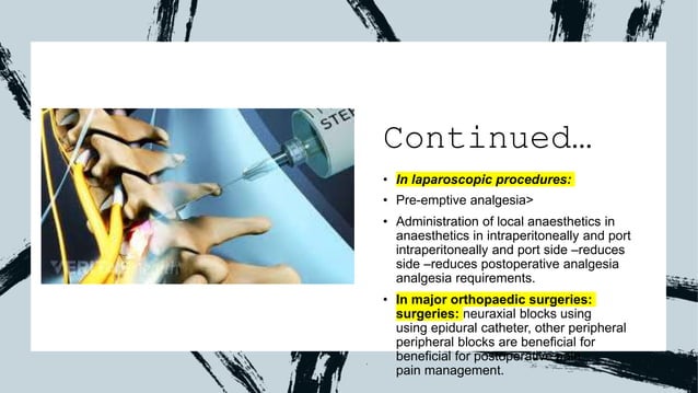 Management of Post Operative Pain: to make doctors conscious about the benefits of multimodal ...