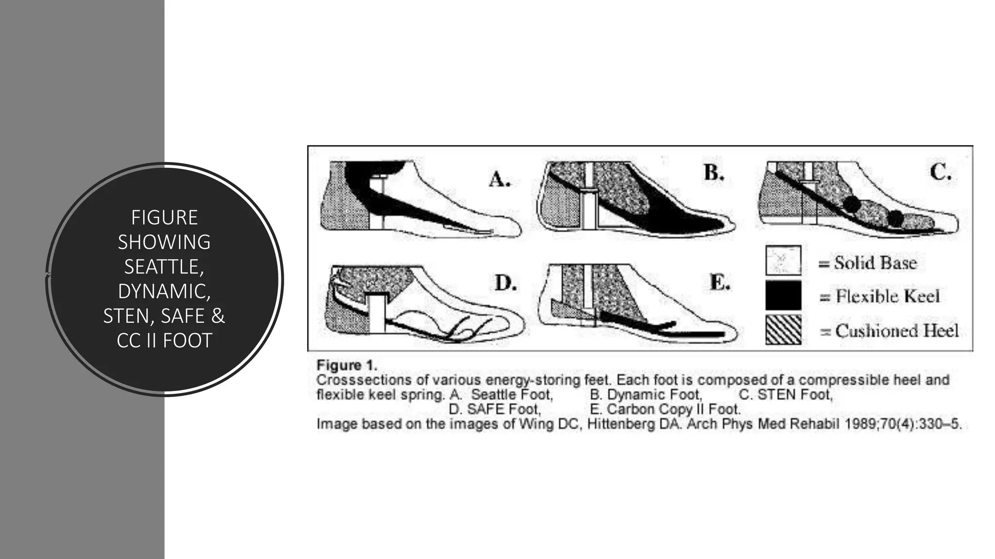 Presentation on prosthetic foot | PPTX