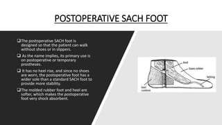 Presentation on prosthetic foot | PPTX