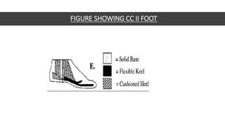 Presentation on prosthetic foot | PPTX
