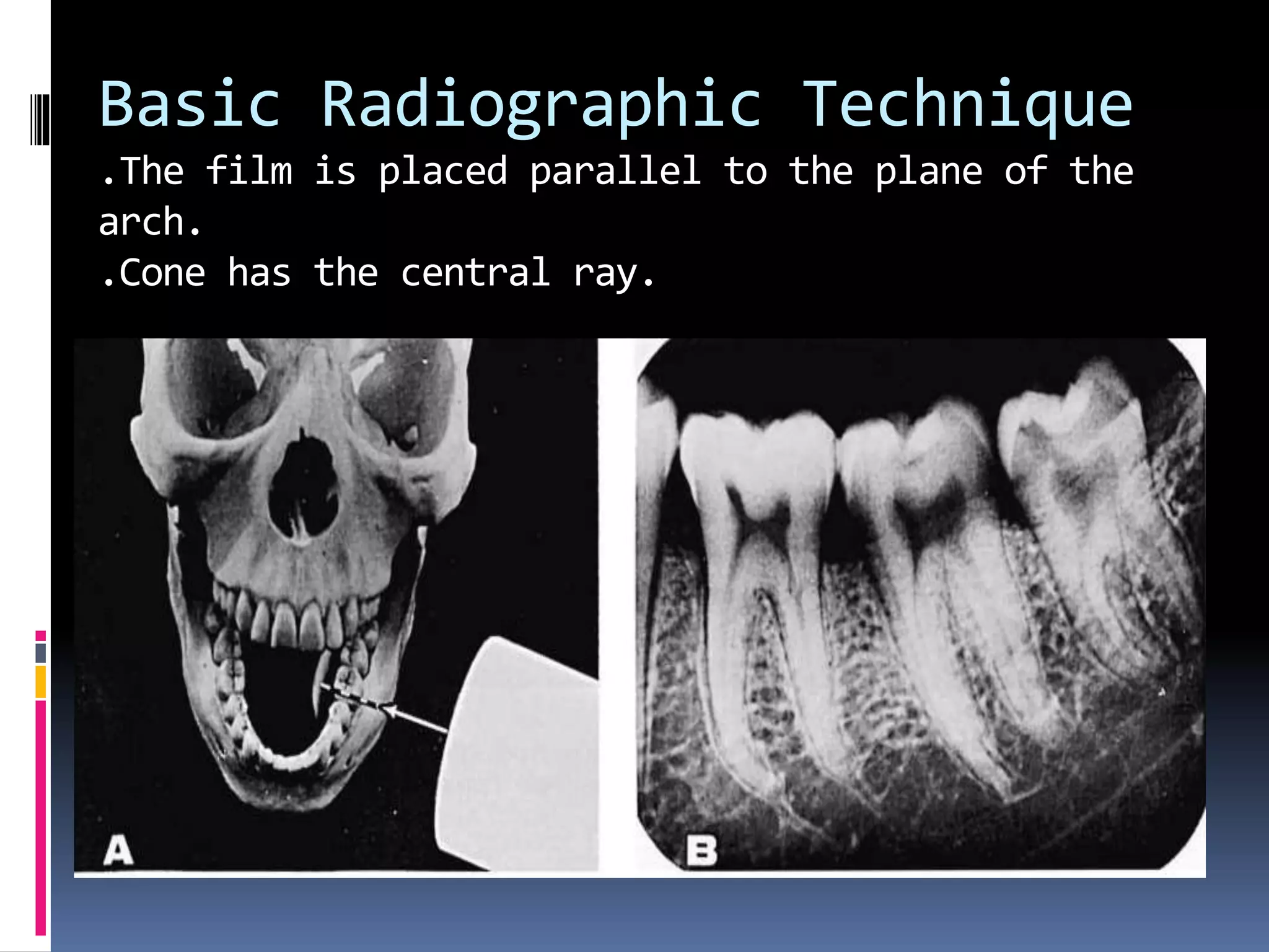 SLOB Technique | PPTX