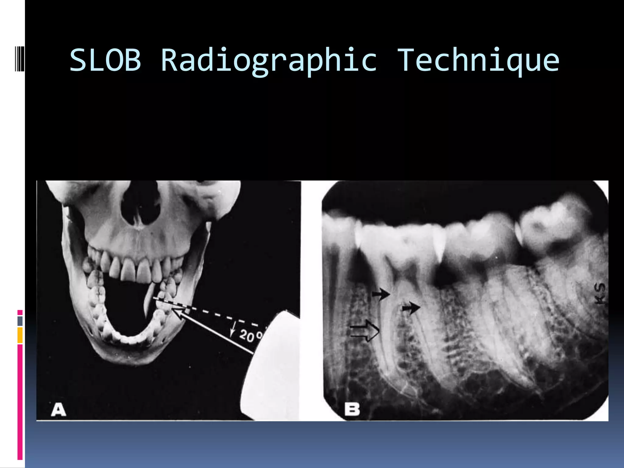 SLOB Technique | PPTX