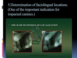 SLOB Technique | PPTX