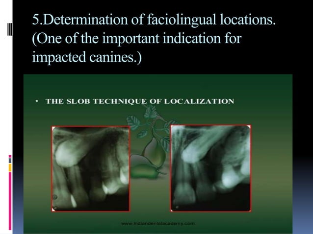 SLOB Technique | PPTX