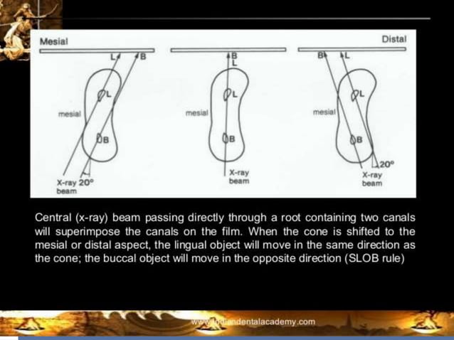 SLOB Technique | PPTX